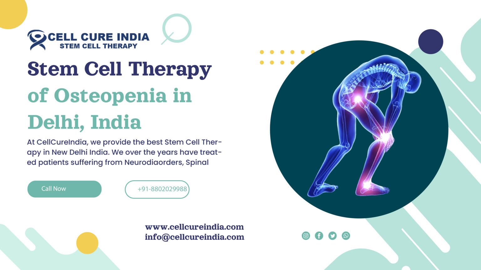 Stem Cell Treatment of Osteopenia in Delhi, India - Cell Cure India